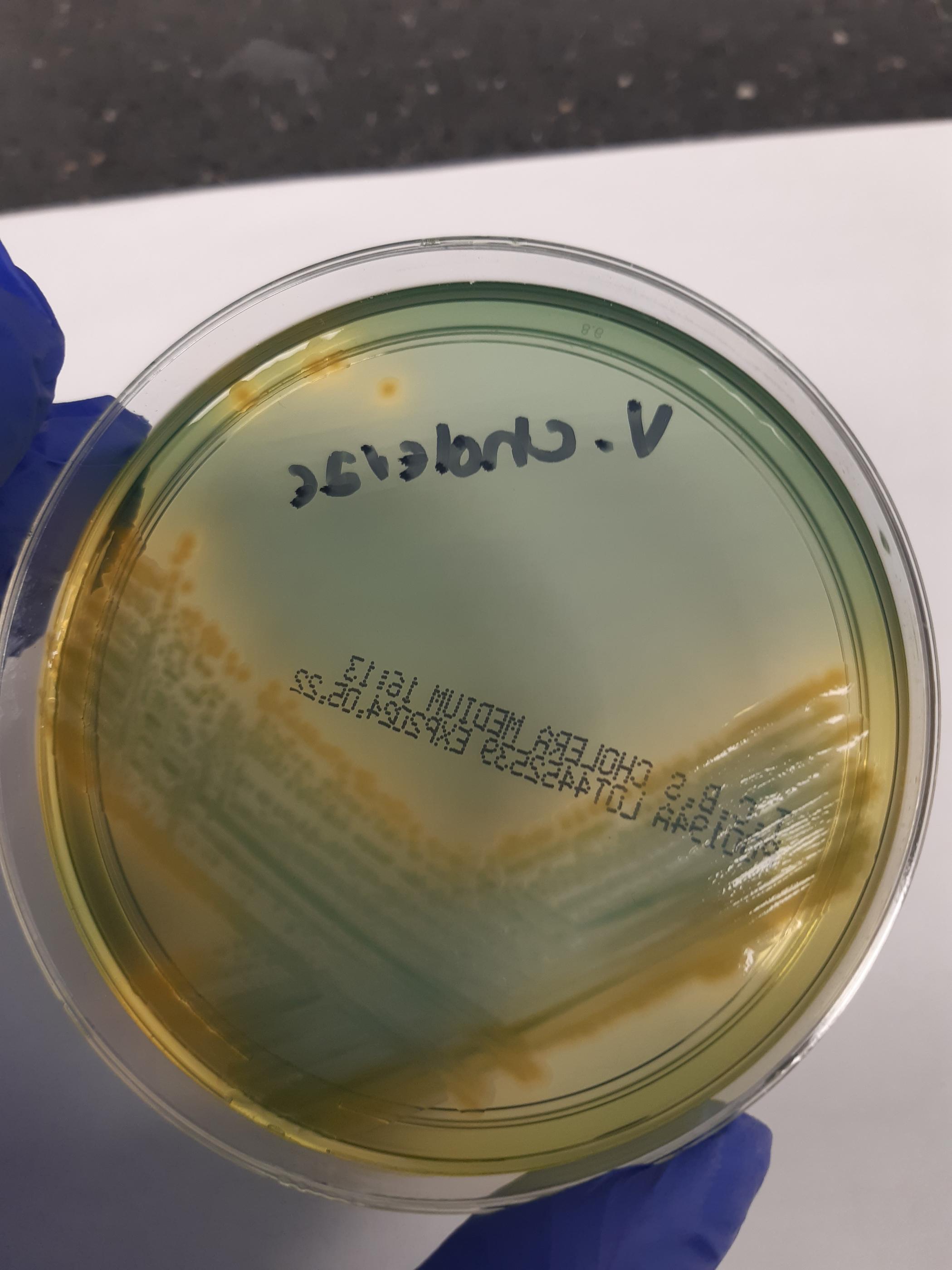 Expert Review of EFSA’s 2024 Report on Vibrio Bacteria in Seafood